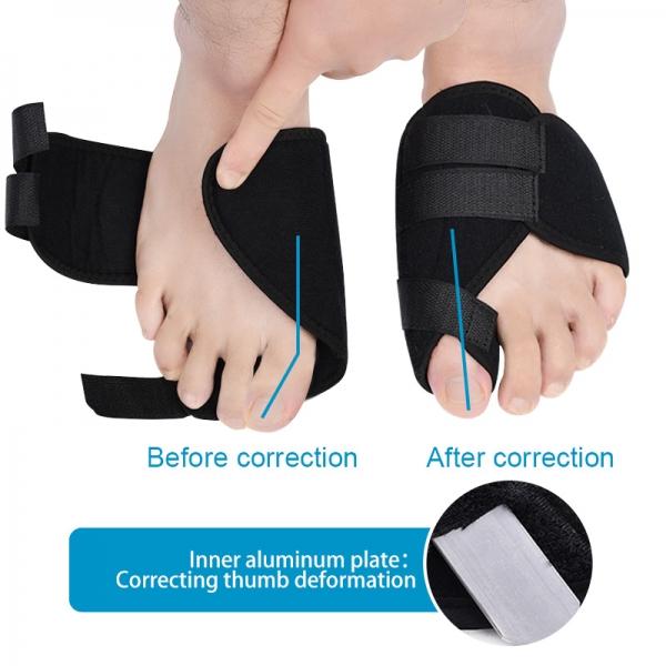Hallux Valgus Correction Tape Ectropion Toe Separator Outer Orthotics ...