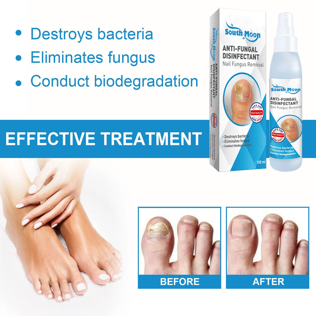 Nail Repair Spray Fungus Treatments Anti Infection Onychomycosis Paro ...